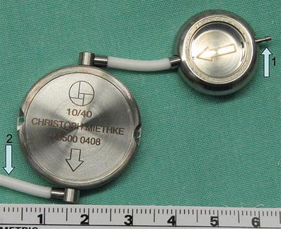 Miethke DualSwitch Valve in lumboperitoneal shunts | SpringerLink