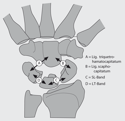 Begutachtung der SL- und LT-Band-Schäden | SpringerLink