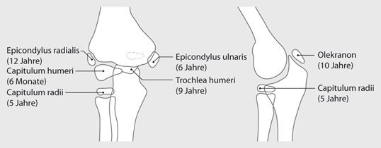 Gelenknahe Frakturen der oberen Extremität im Kindes- und Jugendalter ...