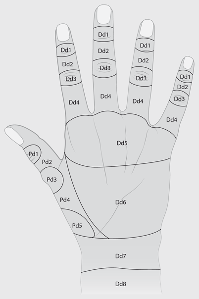 Therapie der akuten Sehnenverletzung an der Hand | SpringerLink