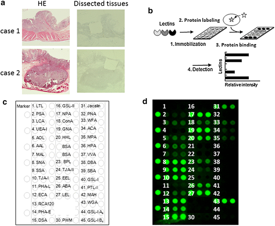 Lectin microarray technology identifies specific lectins related to ...