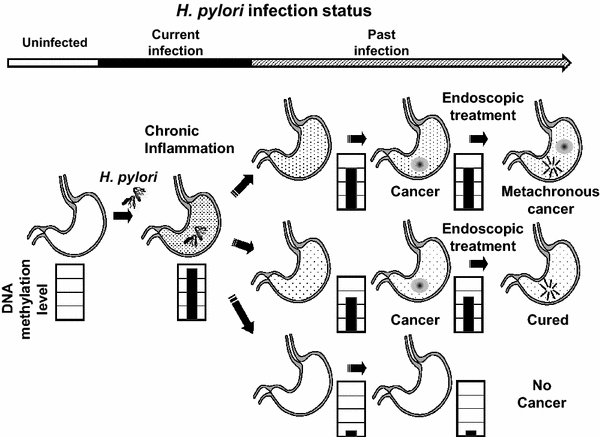 Mechanisms for the induction of gastric cancer by Helicobacter pylori ...