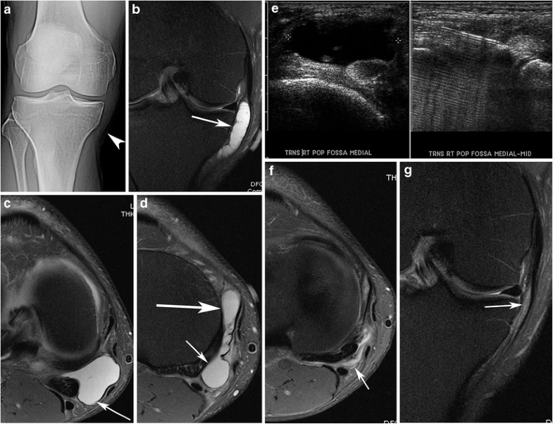 Structure and function, injury, pathology, and treatment of the medial ...