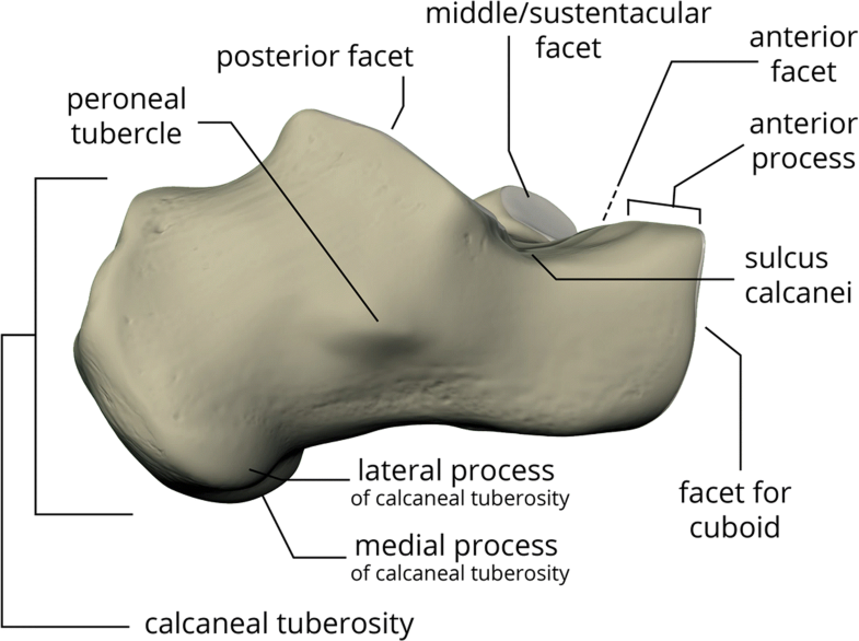 Intra-articular tongue-type fractures of the calcaneus: anatomy, injury ...