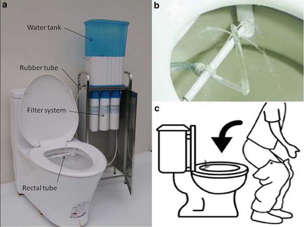 Treatment of irritable bowel syndrome with a novel colonic irrigation ...