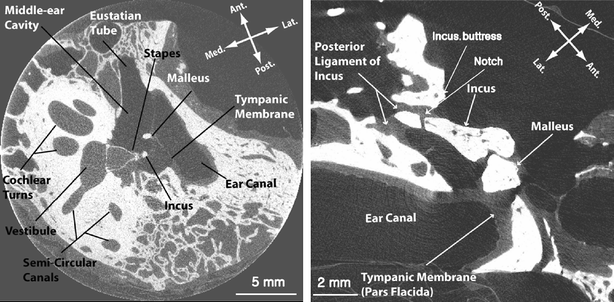 Soft Tissue Morphometry of the Malleus–Incus Complex from Micro-CT ...