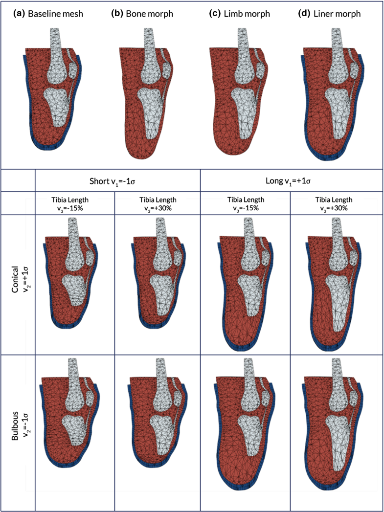 Predictive prosthetic socket design: part 1—population-based evaluation ...