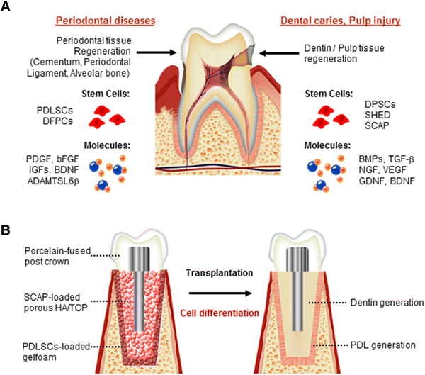 Functional tooth regenerative therapy: tooth tissue regeneration and ...