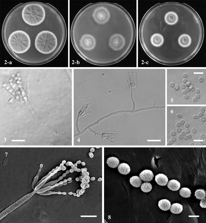 Penicillium viticola, a new species isolated from a grape in Japan ...