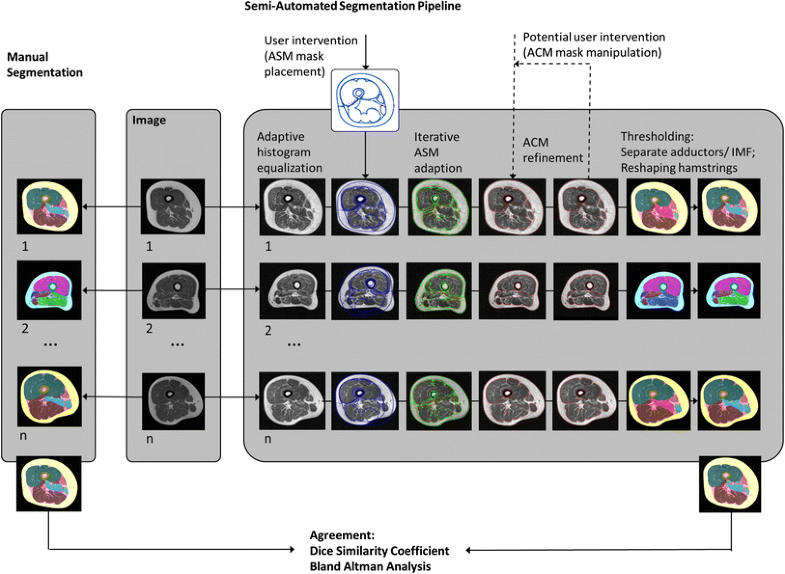 Validation of an active shape model-based semi-automated segmentation algorithm for the analysis ...