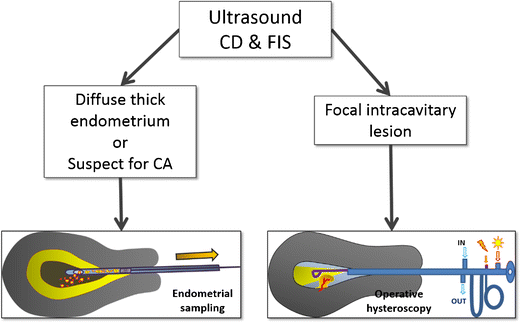 Ultrasound examination before, during, and after office endometrial ...