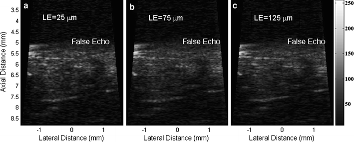 Pulse Inversion Chirp Coded Tissue Harmonic Imaging (PI-CTHI) of ...