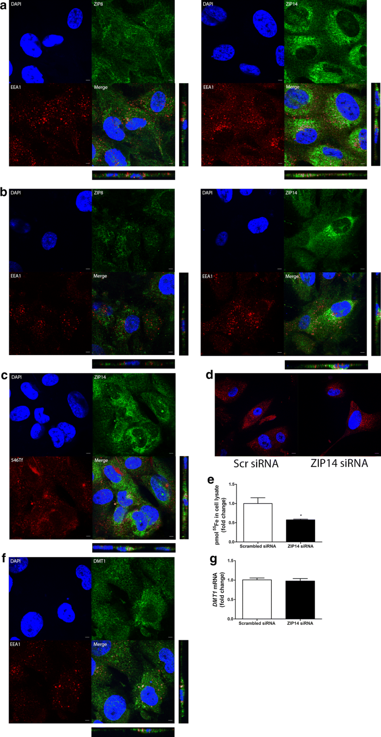 Iron uptake by ZIP8 and ZIP14 in human proximal tubular epithelial ...