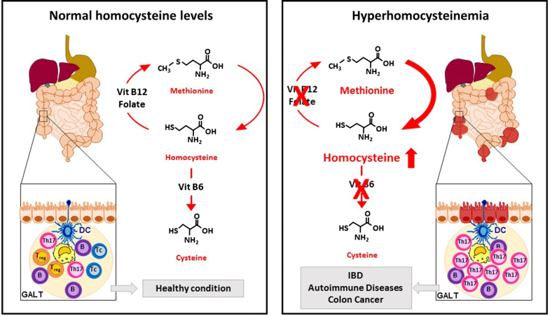 Homocysteine and Folate in Inflammatory Bowel Disease: Can Reducing ...