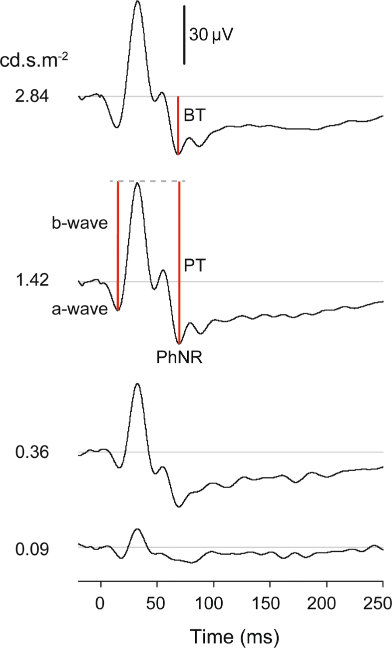 ISCEV extended protocol for the photopic negative response (PhNR) of ...