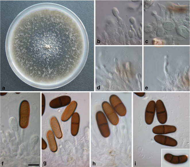 Phylogeny, morphology and pathogenicity of Botryosphaeriaceae ...