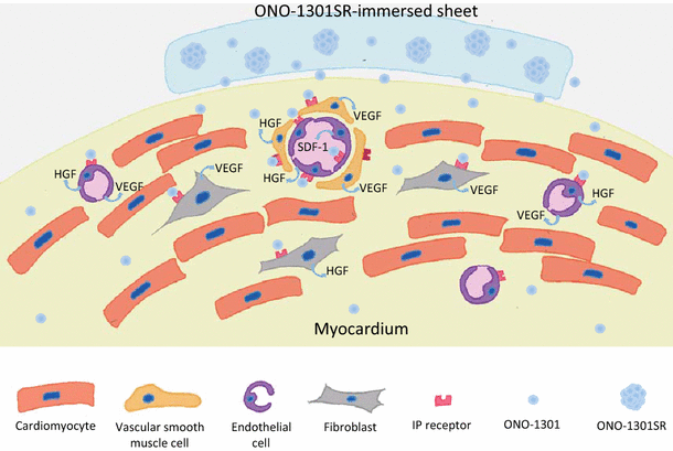 A sustained-release drug-delivery system of synthetic prostacyclin ...