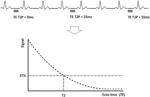T2 mapping and T2* imaging in heart failure | SpringerLink