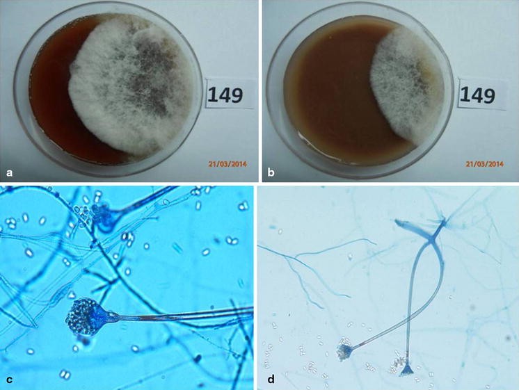 Apophysomyces elegans: a novel cause of endogenous endophthalmitis in ...