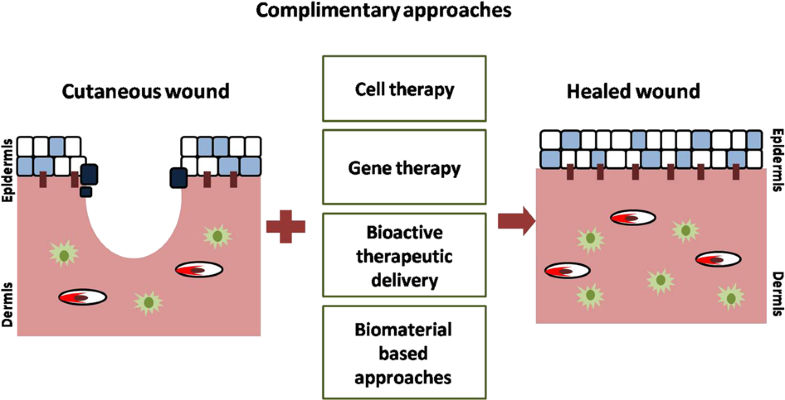 A review of accelerated wound healing approaches: biomaterial- assisted ...