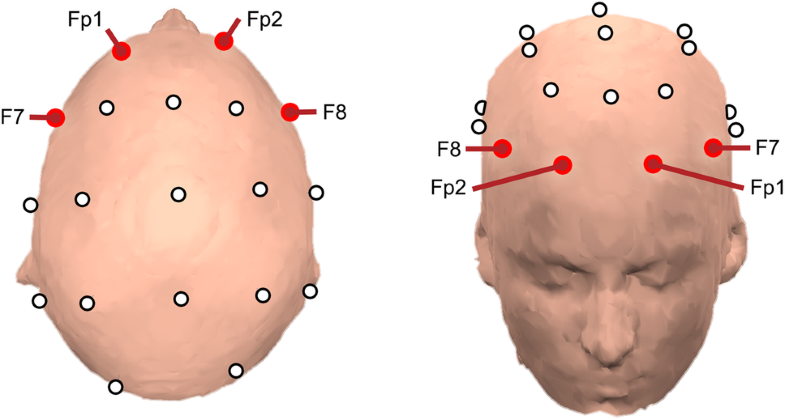 Forehead electrodes sufficiently detect propofol-induced slow waves for ...