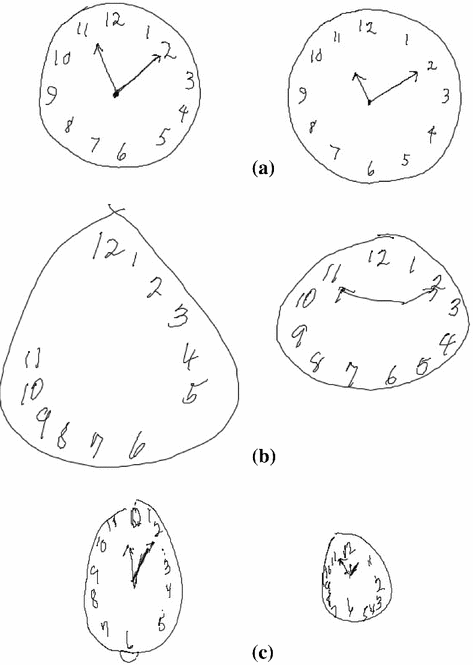 Learning classification models of cognitive conditions from subtle ...
