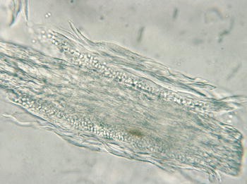 Dermatophytoses in Animals | SpringerLink