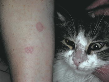 Dermatophytoses in Animals | SpringerLink