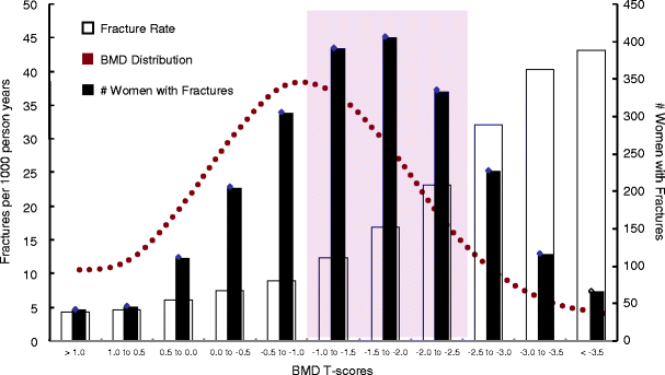 Treatment of osteopenia | SpringerLink
