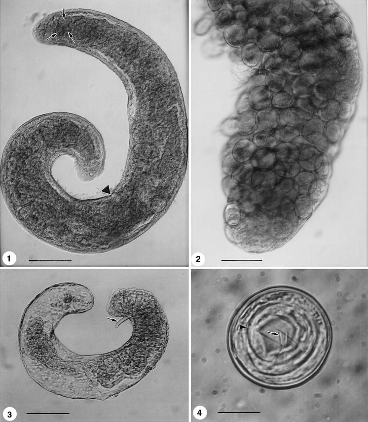 Myrmeconema neotropicum n. g., n. sp., a new tetradonematid nematode parasitising South American ...