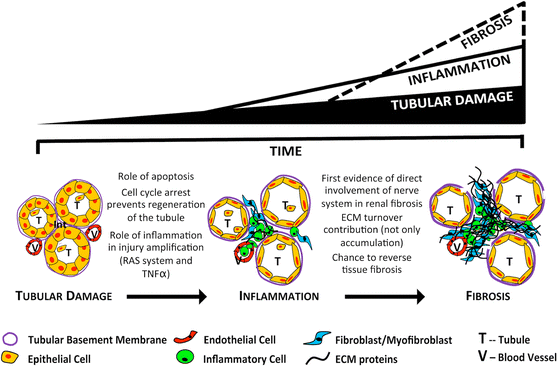 Unilateral ureteral obstruction: beyond obstruction | SpringerLink