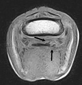 Tenoscopy of the navicular bursa: a new therapeutic approach for horses ...