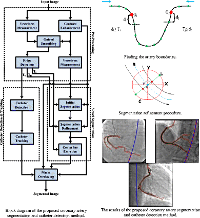 Vessel segmentation and catheter detection in X-ray angiograms using ...