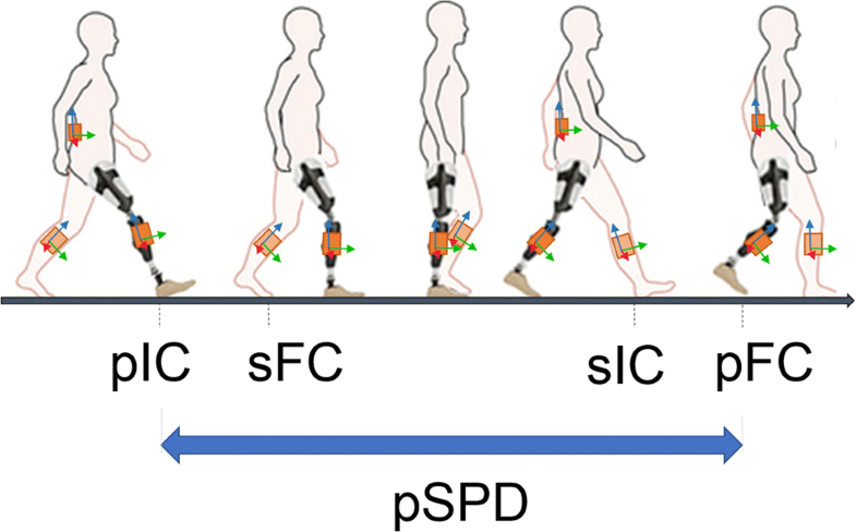 Gait event detection using inertial measurement units in people with transfemoral amputation: a ...