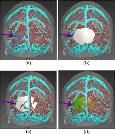 Automated multiple trajectory planning algorithm for the placement of stereo ...