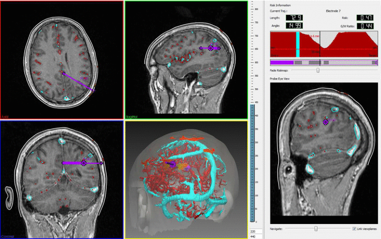 Automated multiple trajectory planning algorithm for the placement of stereo ...