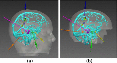 Automated multiple trajectory planning algorithm for the placement of stereo ...