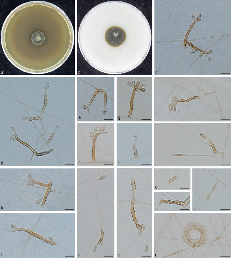 A new species of the oligotrophic genus Ochroconis (Sympoventuriaceae ...