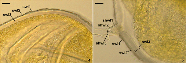 A new genus, Desertispora, and a new species, Diversispora sabulosa, in ...