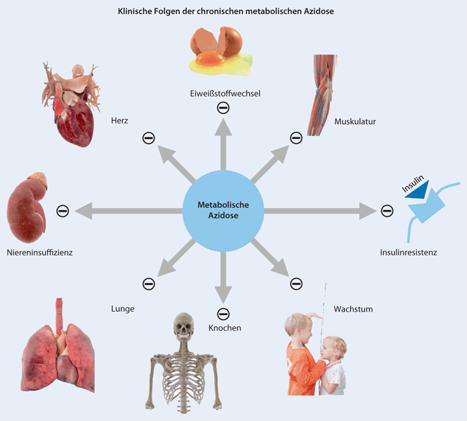 Chronische metabolische Azidose bei Niereninsuffizienz | SpringerLink
