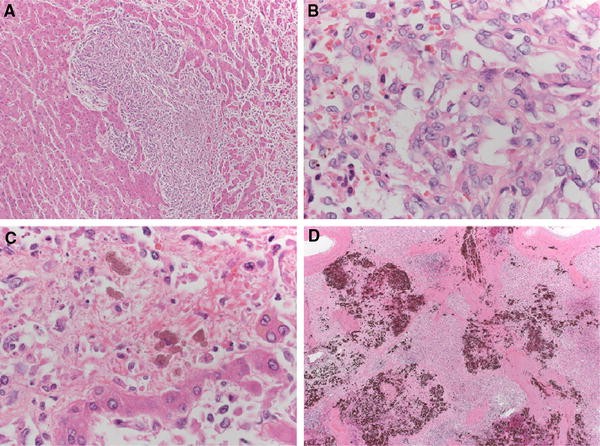 History note: tragedy of Thorotrast | SpringerLink