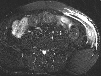 A comprehensive review of imaging findings in human cysticercosis ...