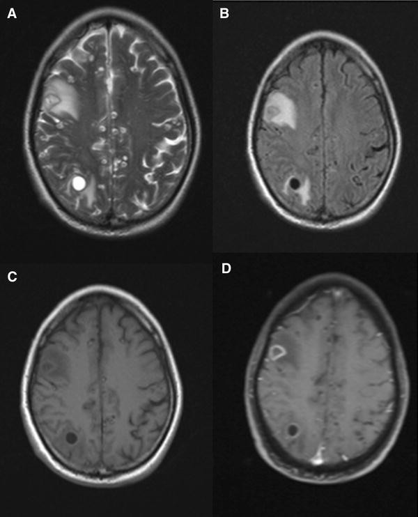 A comprehensive review of imaging findings in human cysticercosis ...