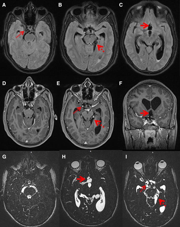 A comprehensive review of imaging findings in human cysticercosis ...