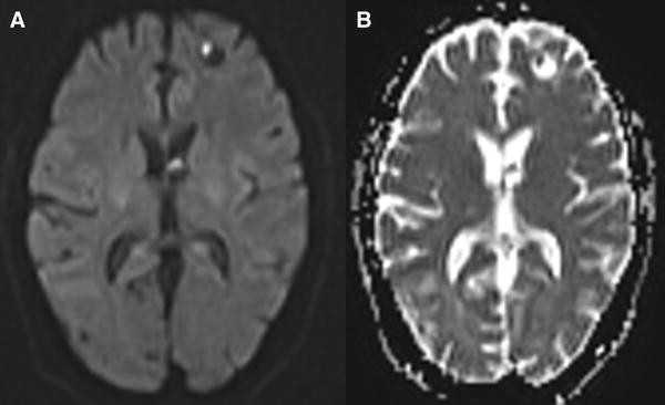 A comprehensive review of imaging findings in human cysticercosis ...