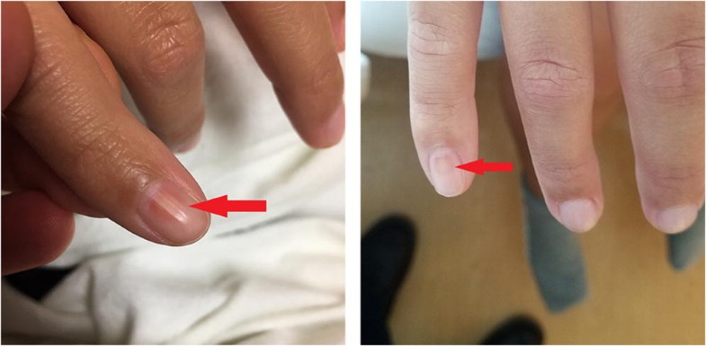 The Oil Drop Sign | SpringerLink