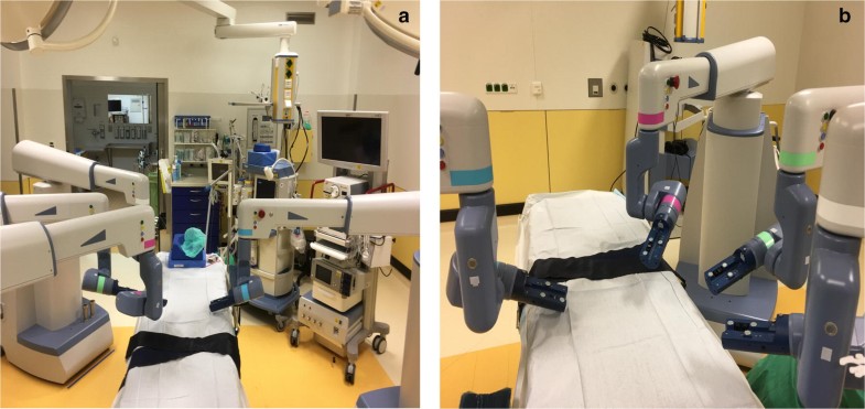 A roadmap for robotic-assisted sigmoid resection in diverticular ...