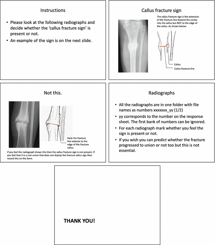 The callus fracture sign: a radiological predictor of progression to ...
