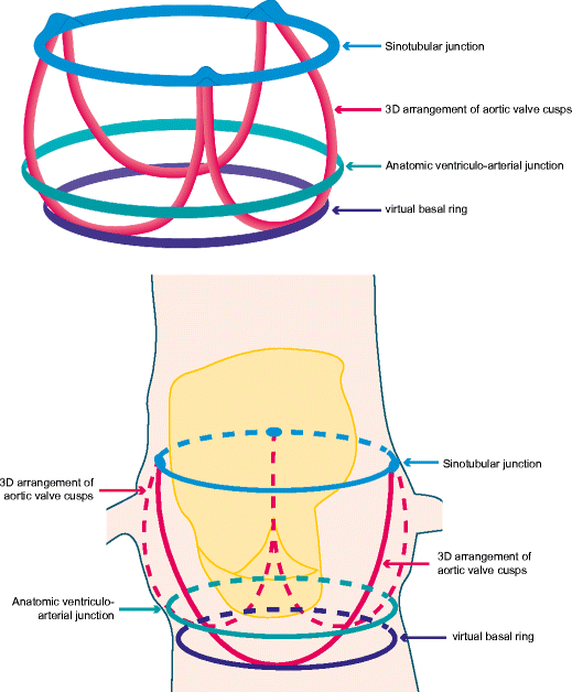The Pivotal Role of Imaging in TAVR Procedures | SpringerLink