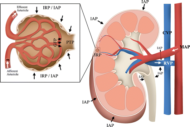 Impact of Systemic Venous Congestion in Heart Failure | SpringerLink